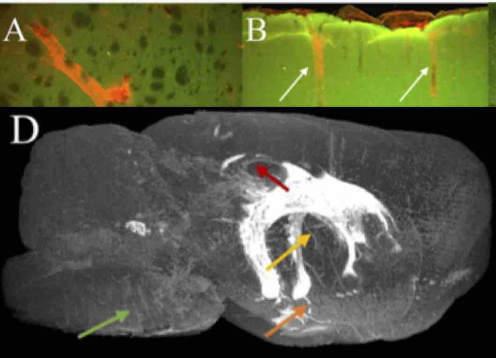 Latest Findings - Soft Tissue Mechanics and Drug Delivery Laboratory